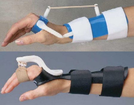 OCCUPATIONAL THERAPY ; SPLINTING: INTRODUCTION