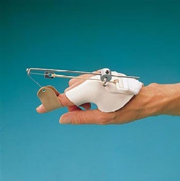 OCCUPATIONAL THERAPY ; SPLINTING: Variety of Splint