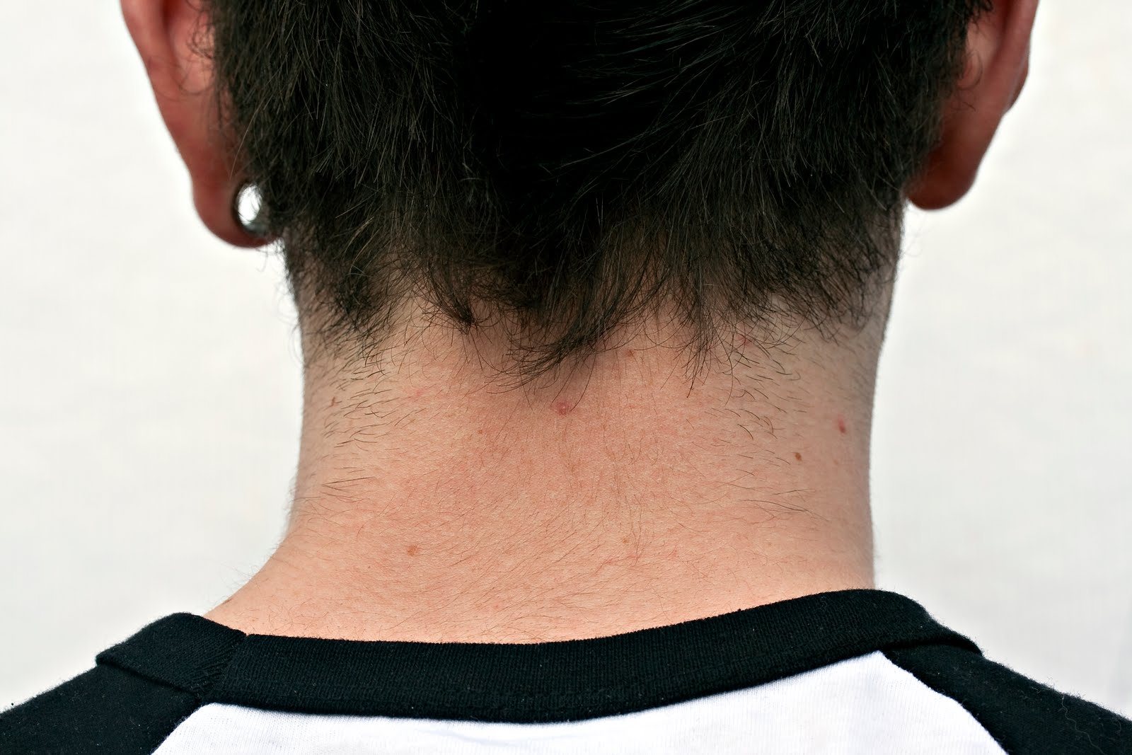 Peter Marley | Paradox Pictures Photography: Somebody [Part V]: Nape