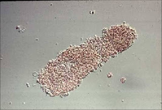 Junaid Mohamed: Microscopic Examination Of Urine