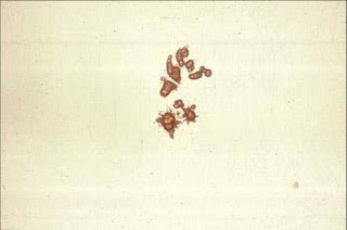 Junaid Mohamed: Microscopic Examination Of Urine