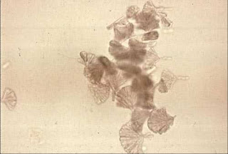 Junaid Mohamed: Microscopic Examination Of Urine