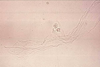Junaid Mohamed: Microscopic Examination Of Urine