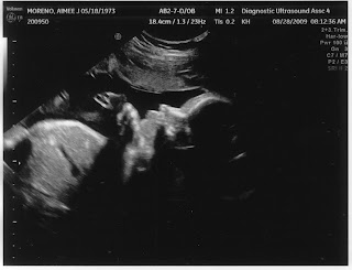 Baby Updates from Tony and Aimee: 29-Weeks-And-5-Days Ultrasound!