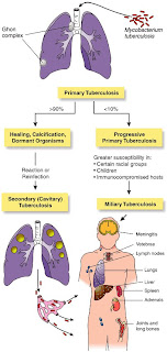 Clinicopathologic: Mycobacterial Infections