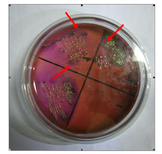 Learning Interesting: Hasil dan Pembahasan Uji MPN (Most Probable Number)