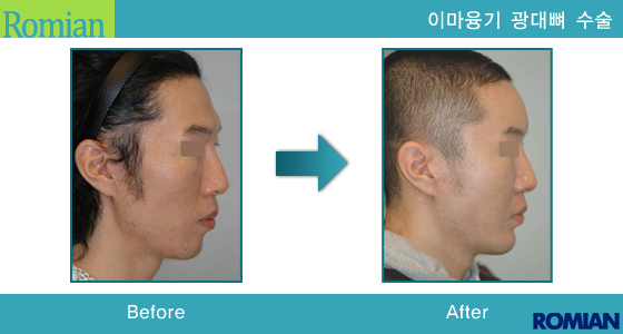 korean plastic surgery clinic