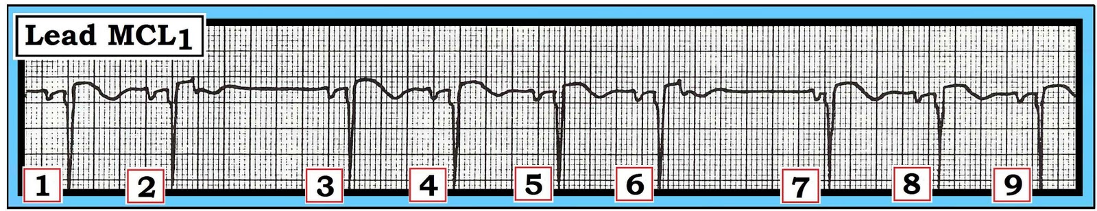 pause, blocked PAC : 네이버 블로그
