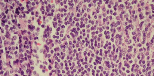 HISTOLOGIA DEL SISTEMA INMUNITARIO: El timo