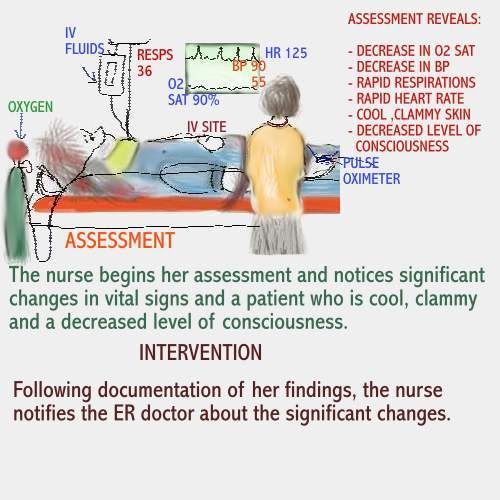 Hypovolemic Shock Nursing