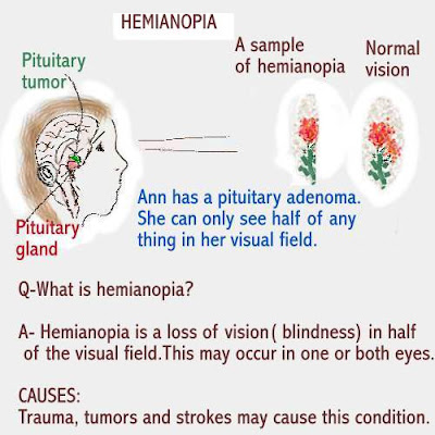 Dear Nurses: June 2008