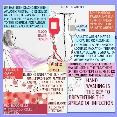 Dear Nurses: WHAT IS APLASTIC ANEMIA