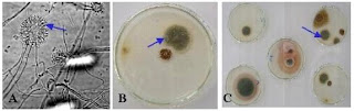 FUNGOS DE IMPORTÂNCIA MÉDICA - MICOTOXICOSES