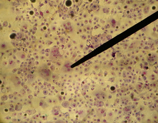 El maravilloso mundo de los microorganismos: ECP VIRAL: SINCITIO