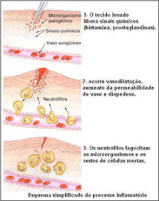 Patologicamente Falando: Fisiopatologia da inflamação
