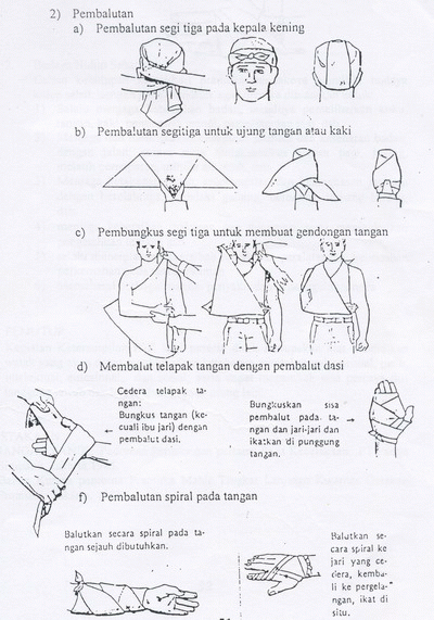 Satya Dharma Bhakti Utama 7: macam-macam pembalutan