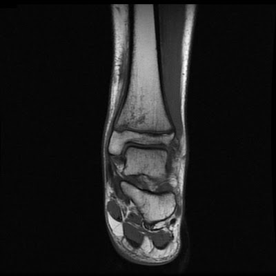 Radiology Cases: November 2008