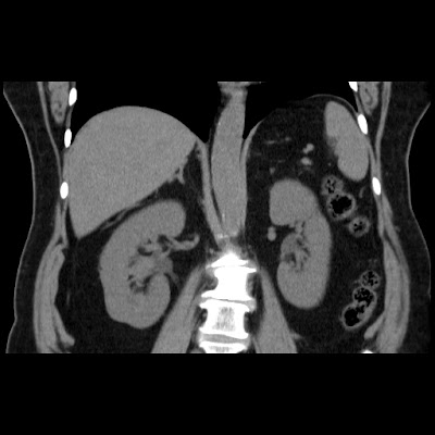 Radiology Cases: March 2009