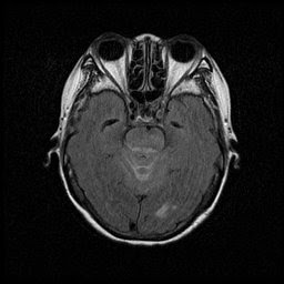 Radiology Cases: March 2009