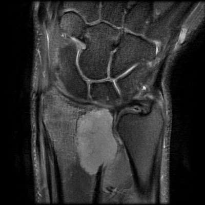 Radiology Cases: April 2009