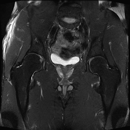 Radiology Cases: October 2010