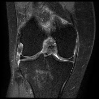 Radiology Cases: October 2010