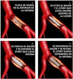 Piernas enfermas