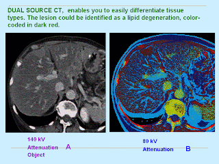 My Radiology World: Dual source ct