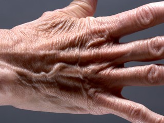 Wrinkles preventive measures ~ DAILY DOSE OF EVERYTHING