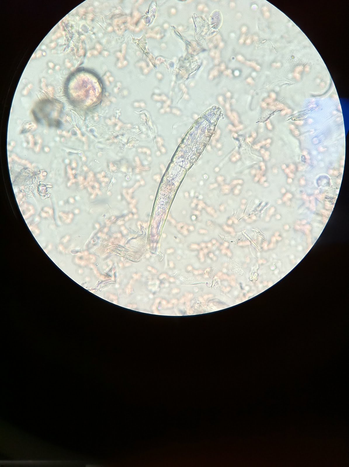 RESCUE A BOXER: Demodex Mite under the Microscope