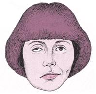 Paralisia Facial Periférica: Definição