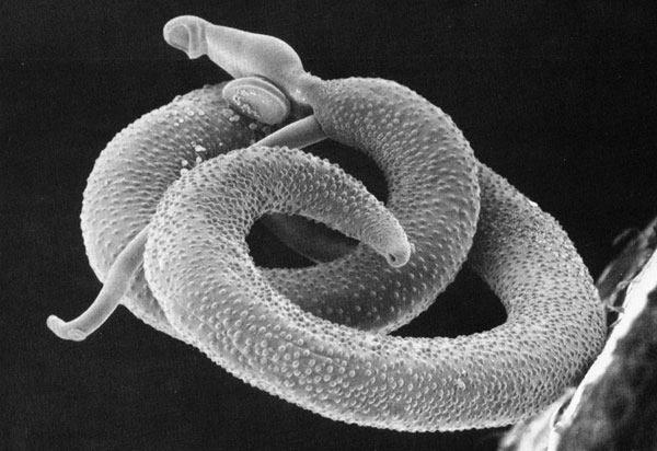 Parasite of the Day: December 3 - Schistosoma mansoni