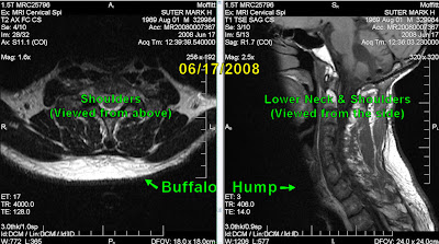 Marks Melon: 06/02/09 - Buffalo Humps and Moon Faces