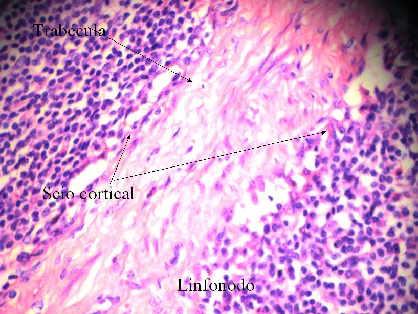Histologia De Linfonodo Rotulada