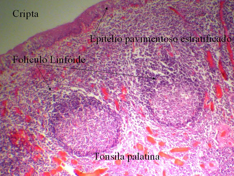 HISTOLOGIA-UFGD: (IM51) TONSILA PALATINA, (100X)
