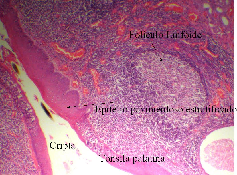 HISTOLOGIA-UFGD: (IM52) TONSILA PALATINA, (100X)
