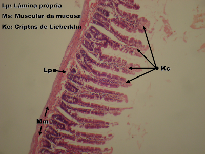 HISTOLOGIA-UFGD: (DF1) INTESTINO DELGADO COM CRIPTAS DE LIEBERKUNHN, (40X)