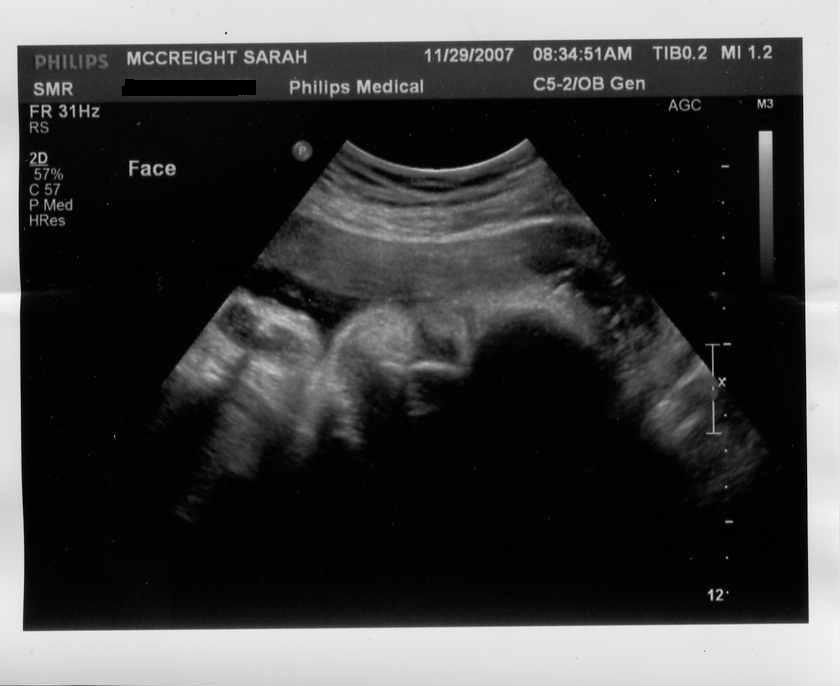 Pregnancy and Parenthood for Dummies: 34 Weeks, 2 Days