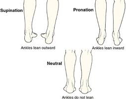 Alpha Sport Lifestyle: Sickled Feet