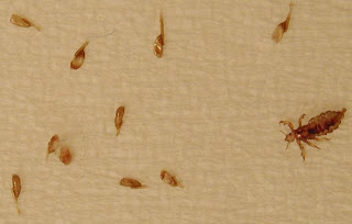 Piolho e Lêndeas (Temos a solução)