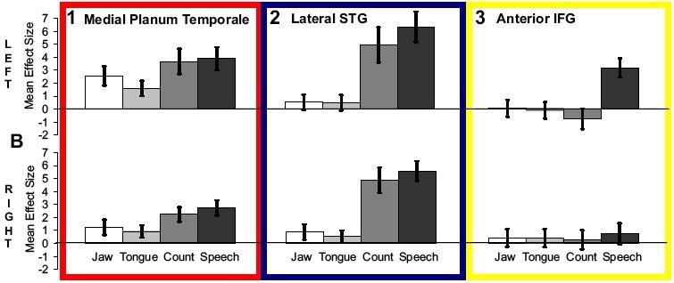 Talking Brains: More evidence for a sensory-motor interface in the ...