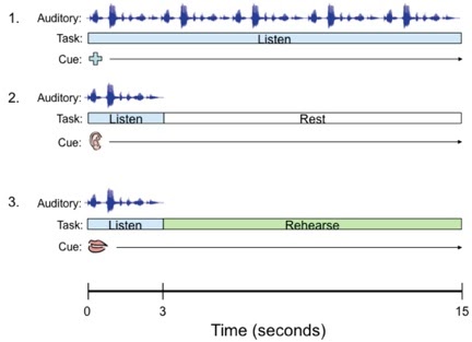 Talking Brains: Area Spt in the planum temporale region: Sensory-motor ...