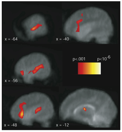 Talking Brains: More on intelligibility: Guest post from Jonathan Peelle