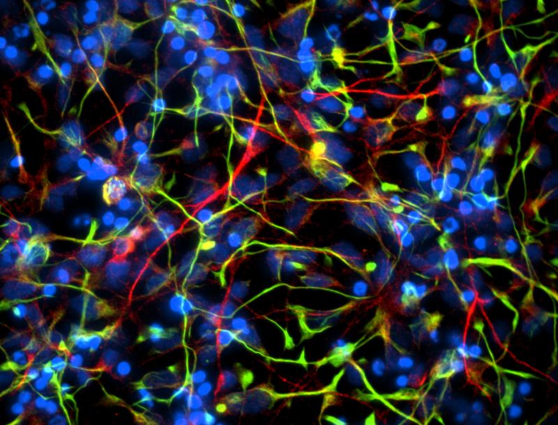 Neuromics: Dr. Steve Stice to Present the Power of StemEZ Neural Cells