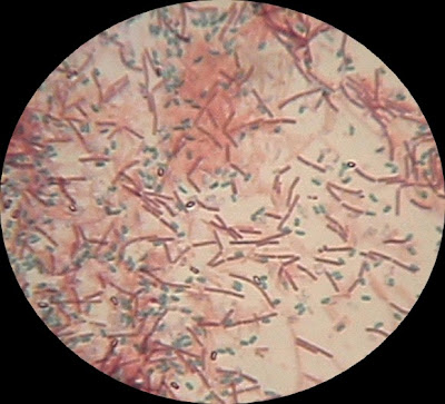 Microbiology: Staining Techniques
