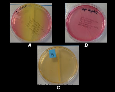 Microbiology: Mannitol Fermentation