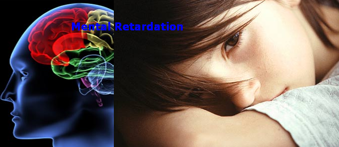 How to Teach Mentally Retarded Children | Accounting Education