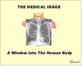 MUTU DAN KARAKTERISTIK CITRA MEDIK | Radiologi X - ray