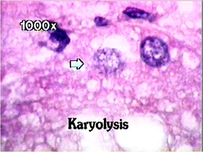 Opiniones de Cariolisis