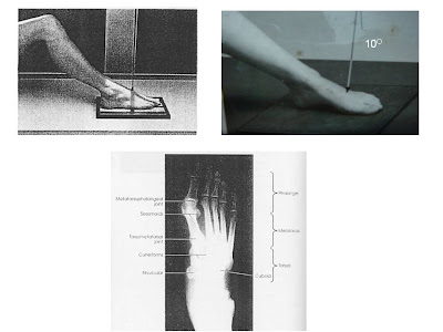 Jejak Radiologi: Teknik Pemeriksaan Pedis